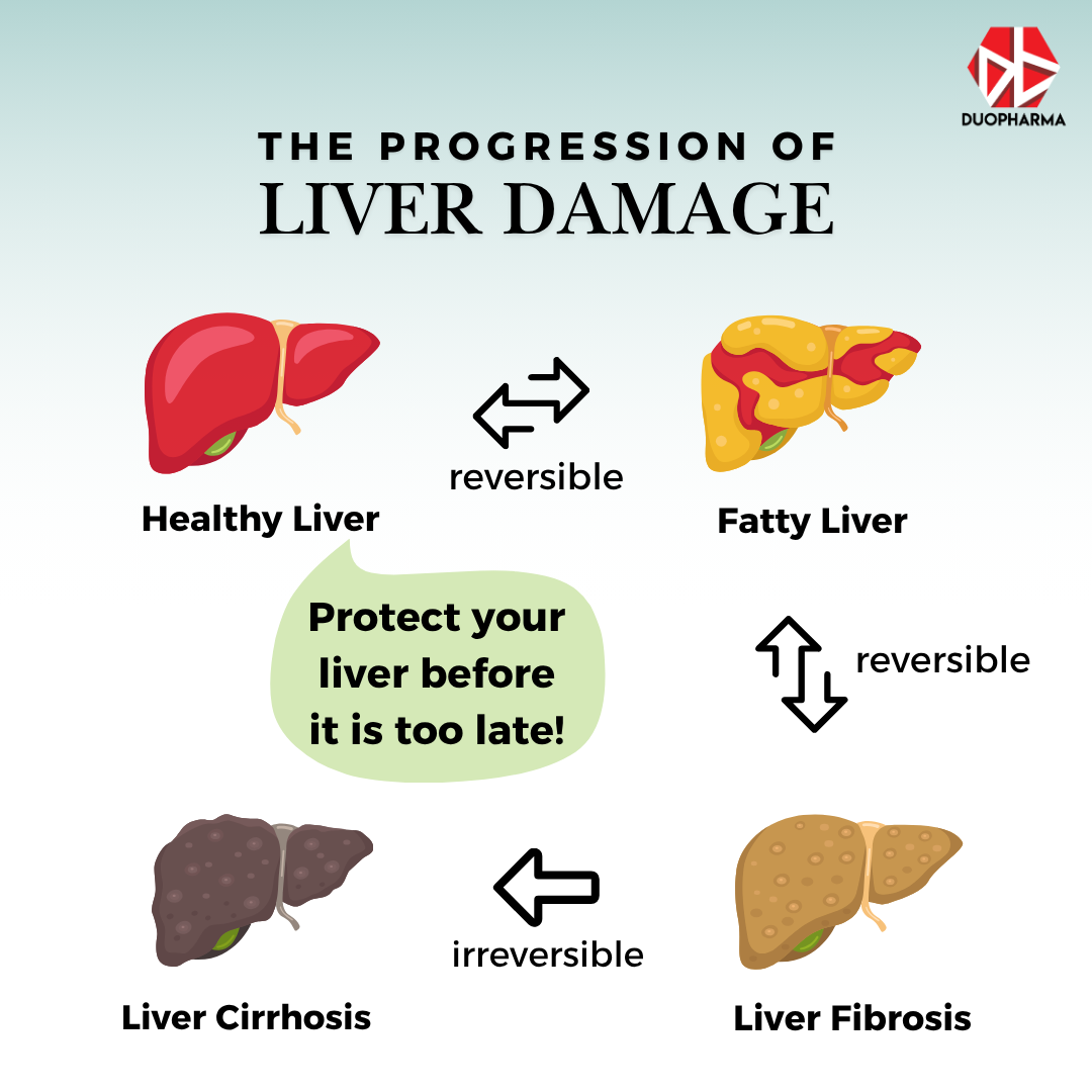Hepalife Forte 30'S Box (New Generation Liver Protector) – Duopharma Online